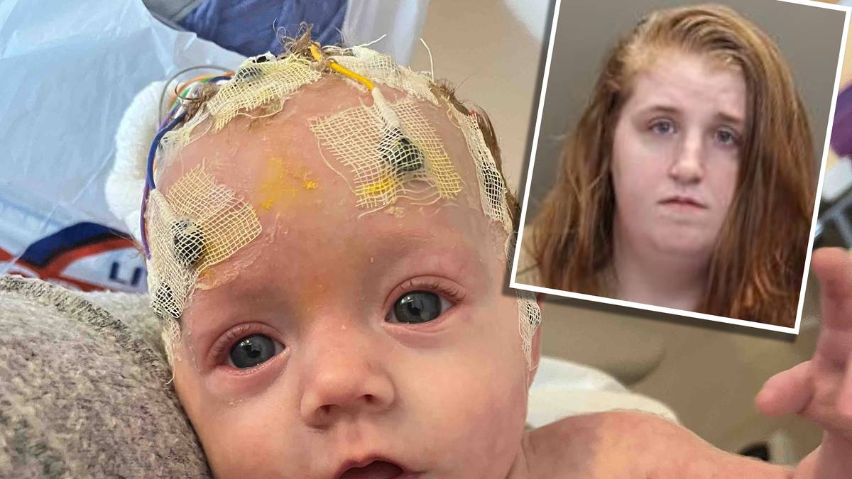 Us Mother Jailed After Injection Puts 9 Month Old Daughter Into Cardiac