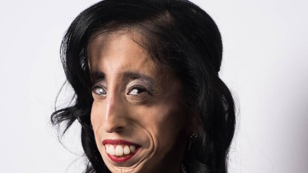 Online Bullies Called Me The Worlds Ugliest Woman Lizzie Velasquez