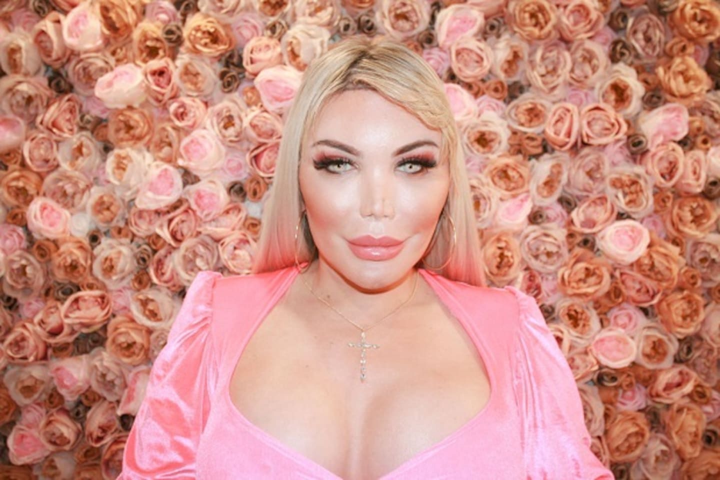 Igor And Grichka Bogdanoff Extreme Plastic Surgery Disasters And Why